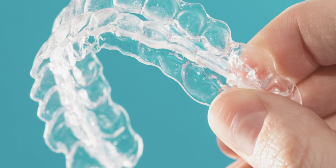 ¿Qué son los retenedores de ortodoncia? - González y Casado